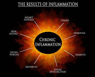Hatha Yoga Reduces Inflammation Response – Life Horizons